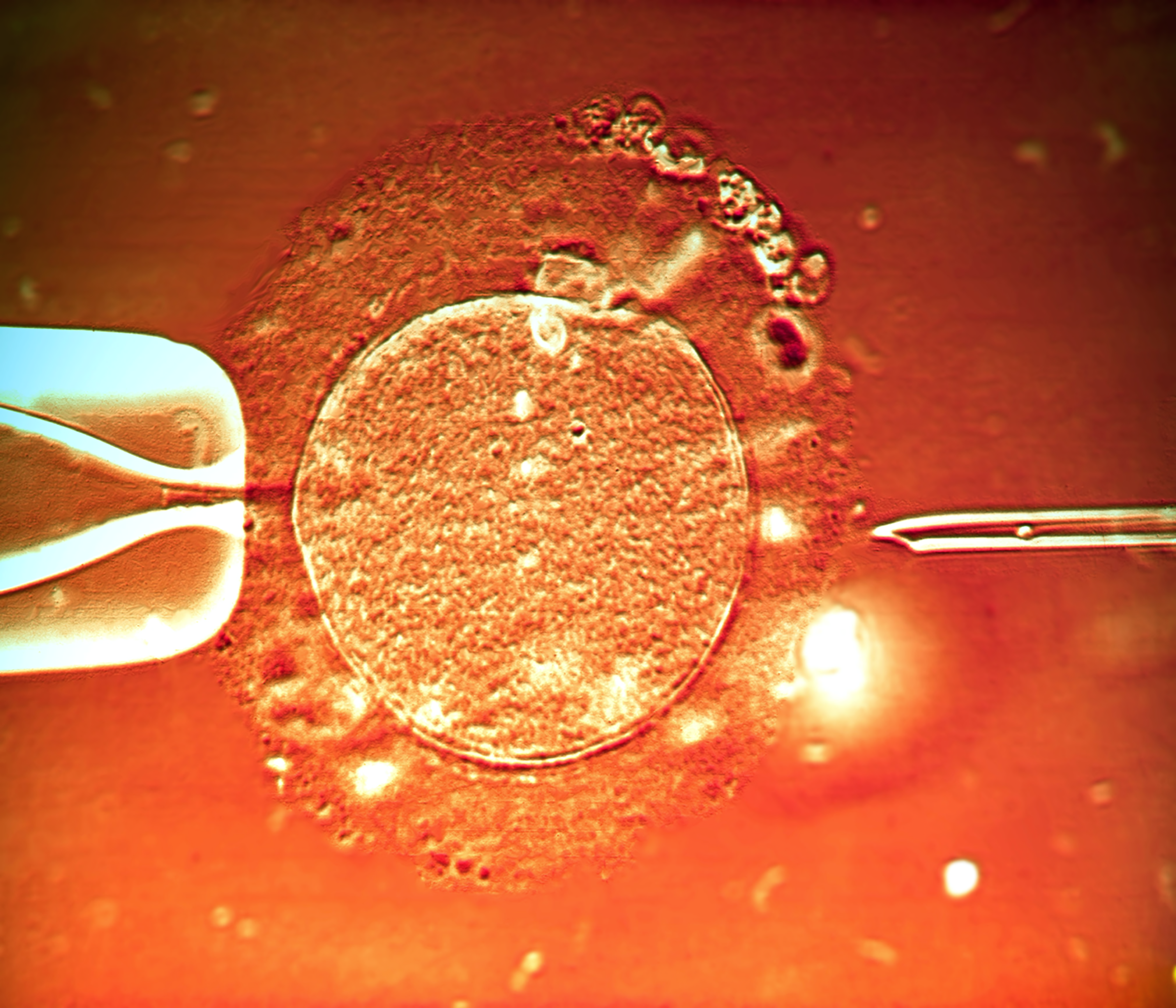 fertilisation time lapse