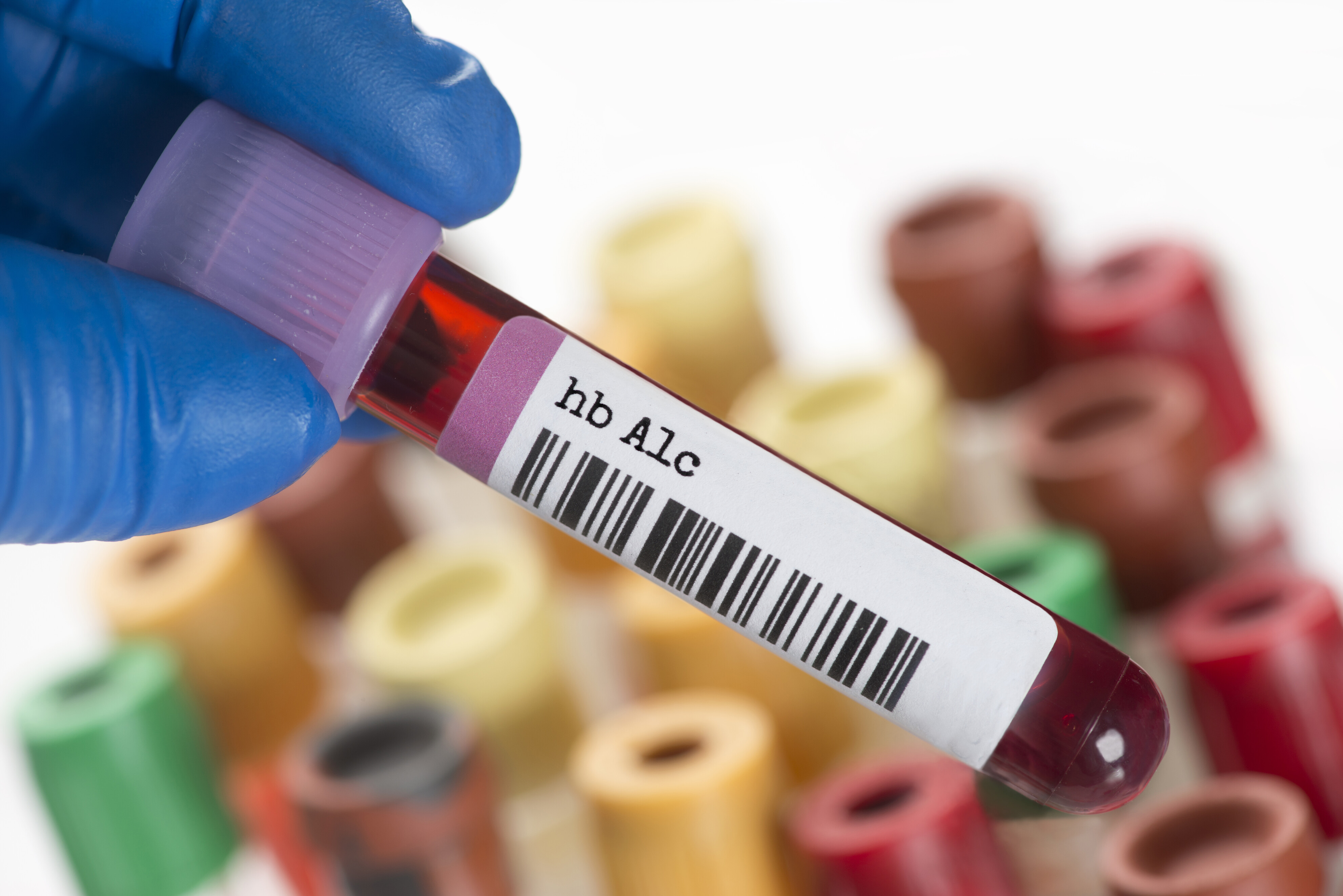 The changing world of diabetes | Croucher Foundation